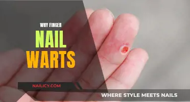 The Itch Under Fingernails: Causes And Cures | Nailicy