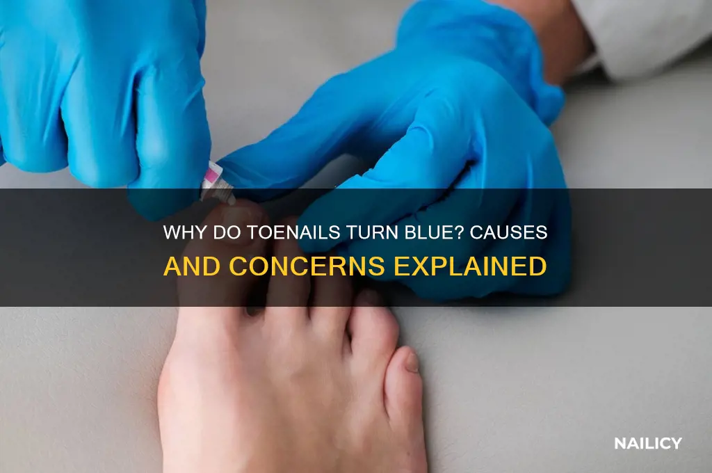 Why Do Toenails Turn Blue? Causes And Concerns Explained | Nailicy