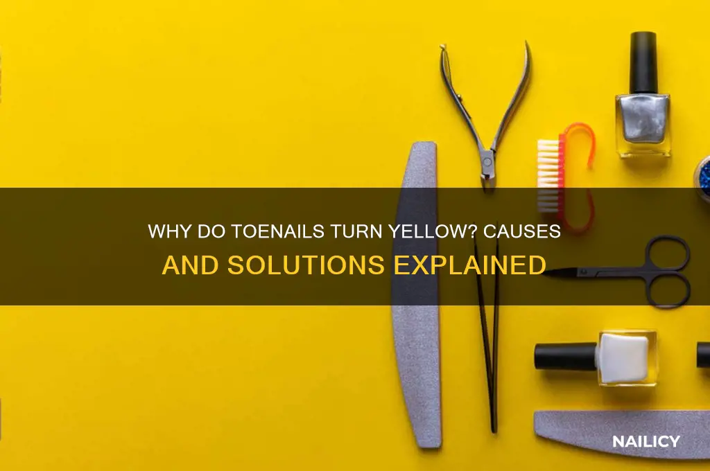Why Do Toenails Turn Yellow? Causes And Solutions Explained | Nailicy