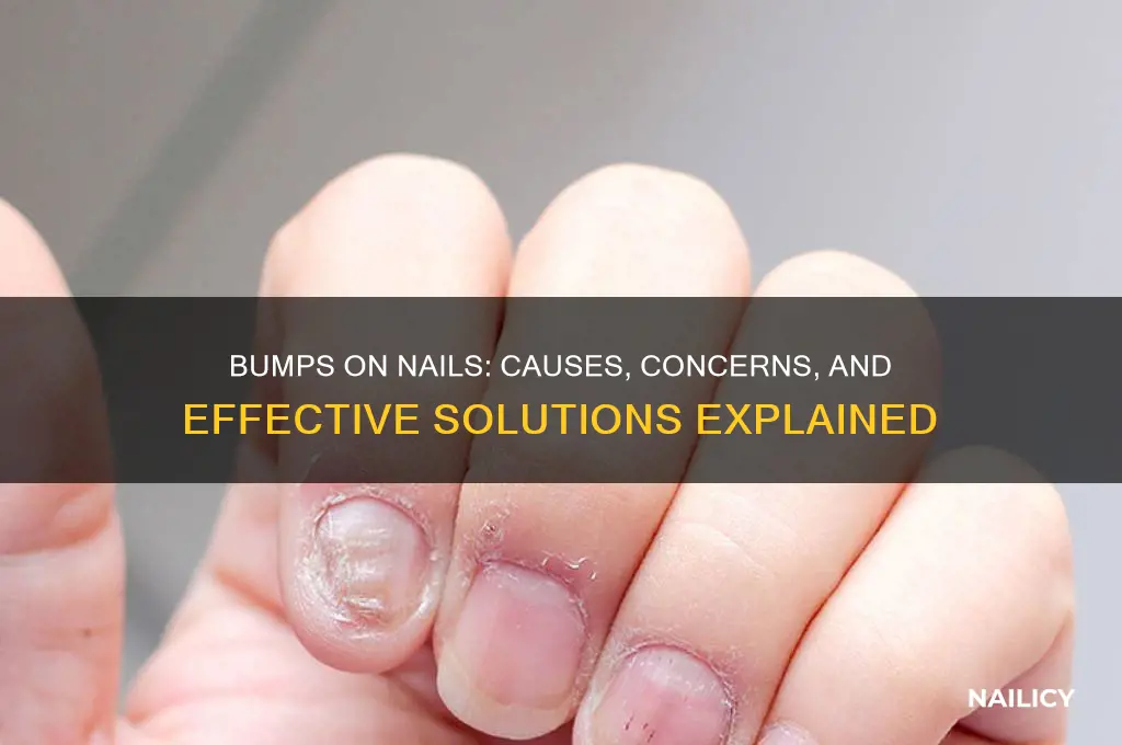 Bumps On Nails: Causes, Concerns, And Effective Solutions Explained ...