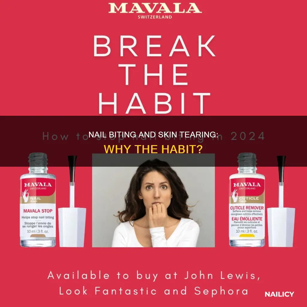 Nail Biting And Skin Tearing: Why The Habit? | Nailicy