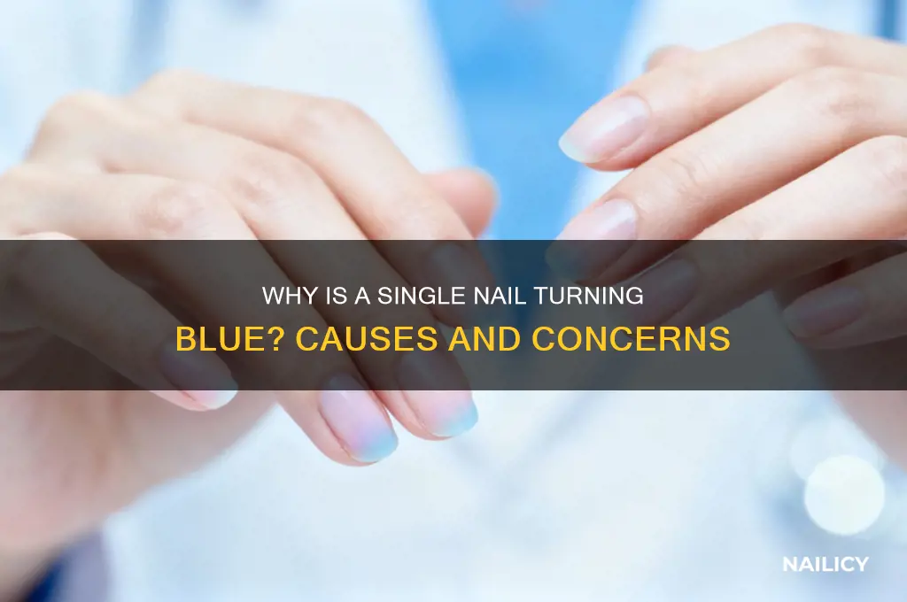 Why Is A Single Nail Turning Blue? Causes And Concerns | Nailicy