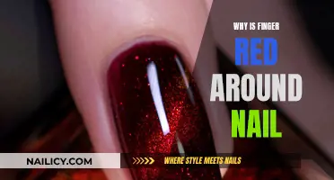 Finger Swelling And Redness: What Does It Mean? | Nailicy