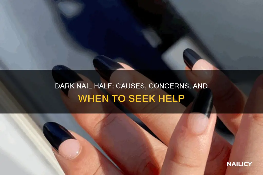 Dark Nail Half: Causes, Concerns, And When To Seek Help | Nailicy