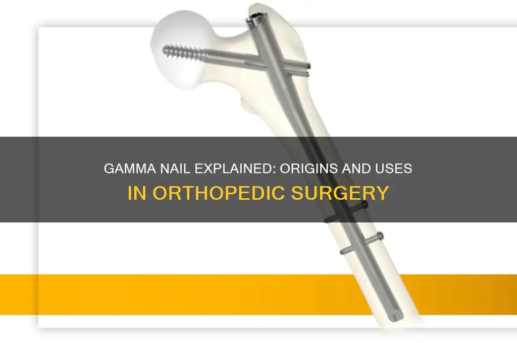 Gamma Nail Explained: Origins And Uses In Orthopedic Surgery | Nailicy