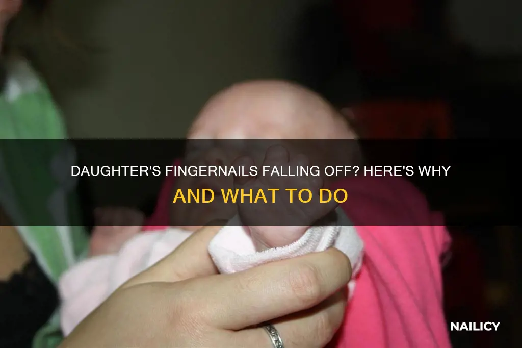 Daughter's Fingernails Falling Off? Here's Why And What To Do | Nailicy