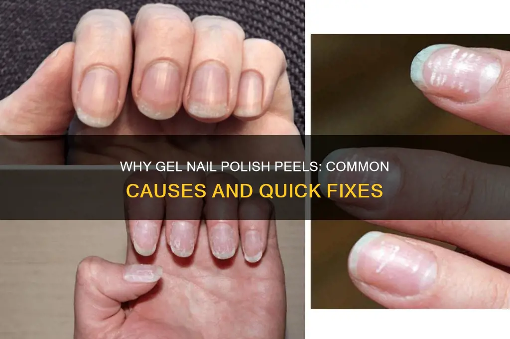 Why Gel Nail Polish Peels: Common Causes And Quick Fixes | Nailicy