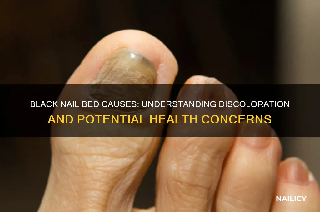 Black Nail Bed Causes: Understanding Discoloration And Potential Health ...