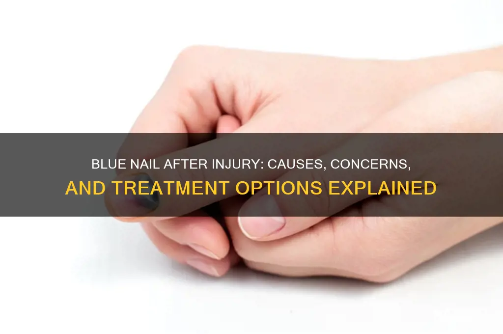Blue Nail After Injury: Causes, Concerns, And Treatment Options ...