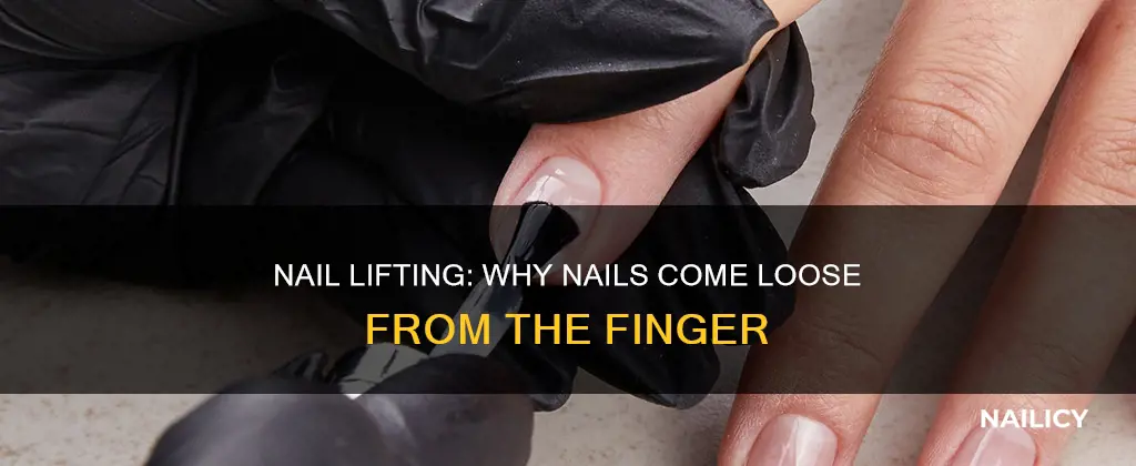 Nail Lifting: Why Nails Come Loose From The Finger | Nailicy
