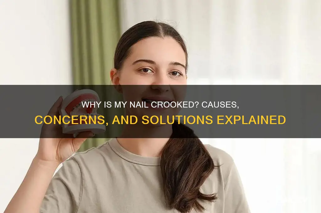 Why Is My Nail Crooked? Causes, Concerns, And Solutions Explained | Nailicy