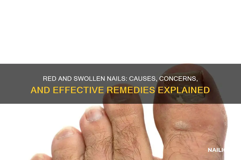 Red And Swollen Nails: Causes, Concerns, And Effective Remedies ...