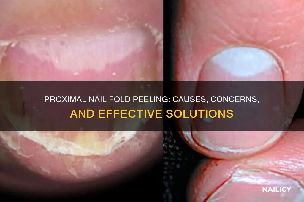 Proximal Nail Fold Peeling: Causes, Concerns, And Effective Solutions ...
