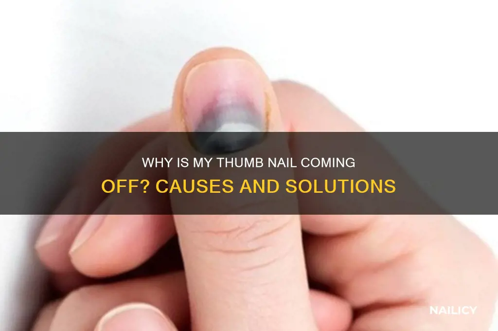 Why Is My Thumb Nail Coming Off? Causes And Solutions | Nailicy