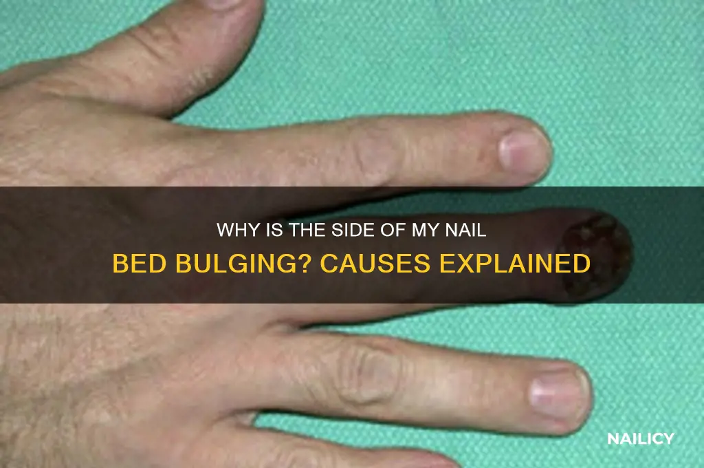 Why Is The Side Of My Nail Bed Bulging? Causes Explained | Nailicy