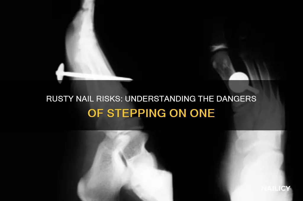 Rusty Nail Risks: Understanding The Dangers Of Stepping On One | Nailicy