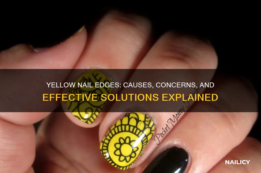 Yellow Nail Edges: Causes, Concerns, And Effective Solutions Explained ...