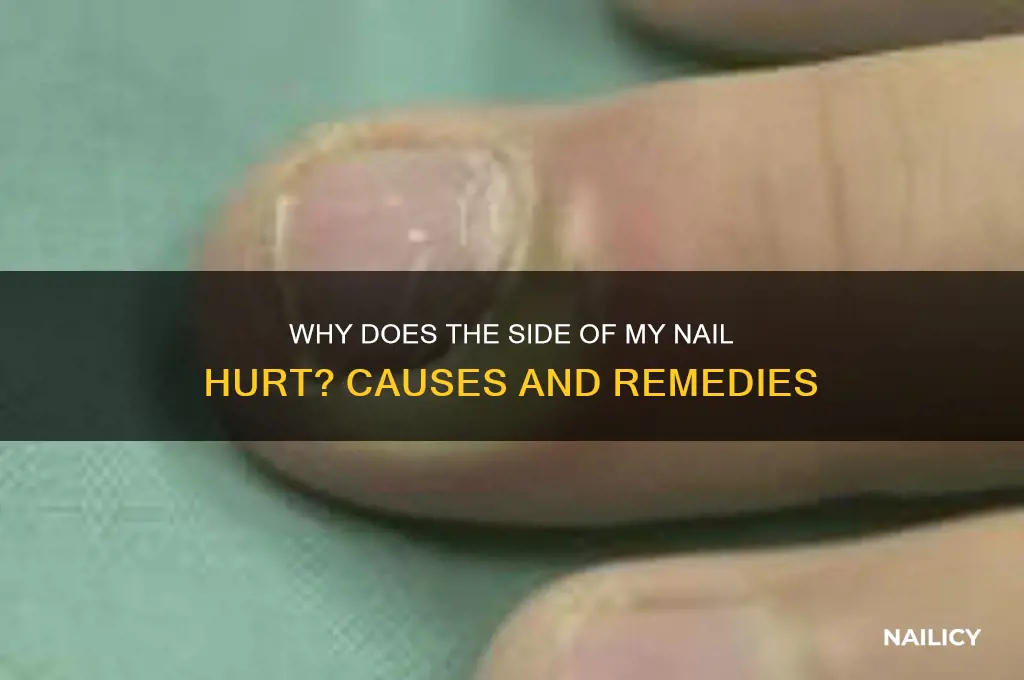 Why Does The Side Of My Nail Hurt? Causes And Remedies | Nailicy