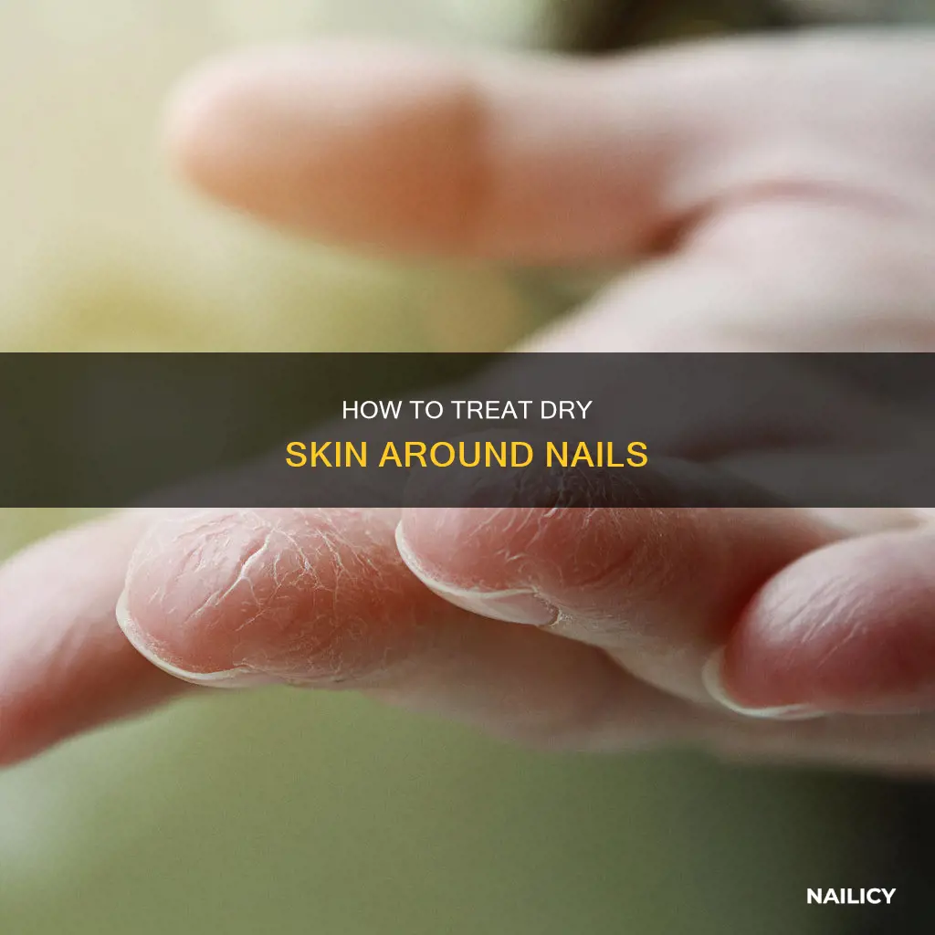 How To Treat Dry Skin Around Nails | Nailicy
