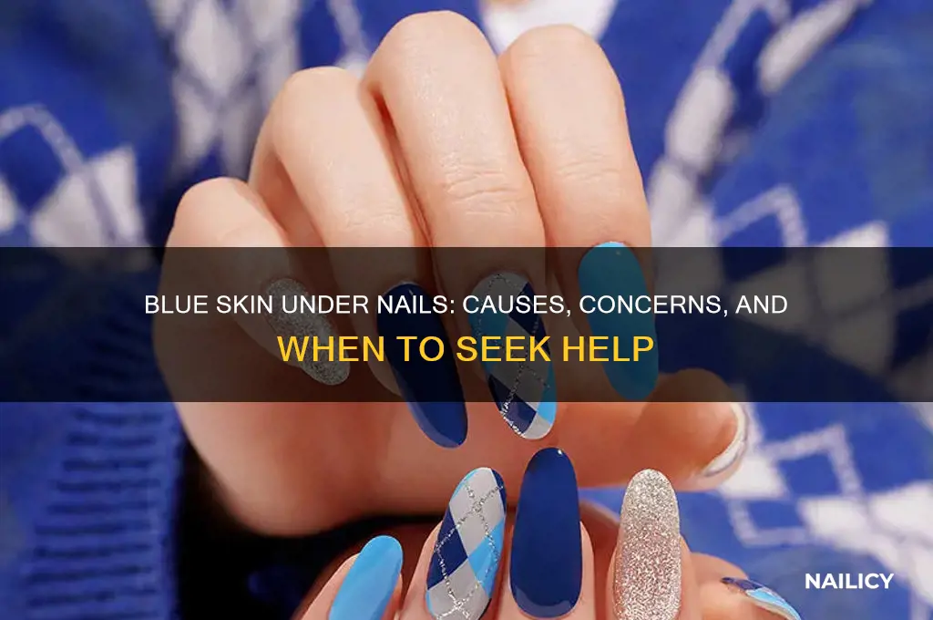 Blue Skin Under Nails: Causes, Concerns, And When To Seek Help | Nailicy