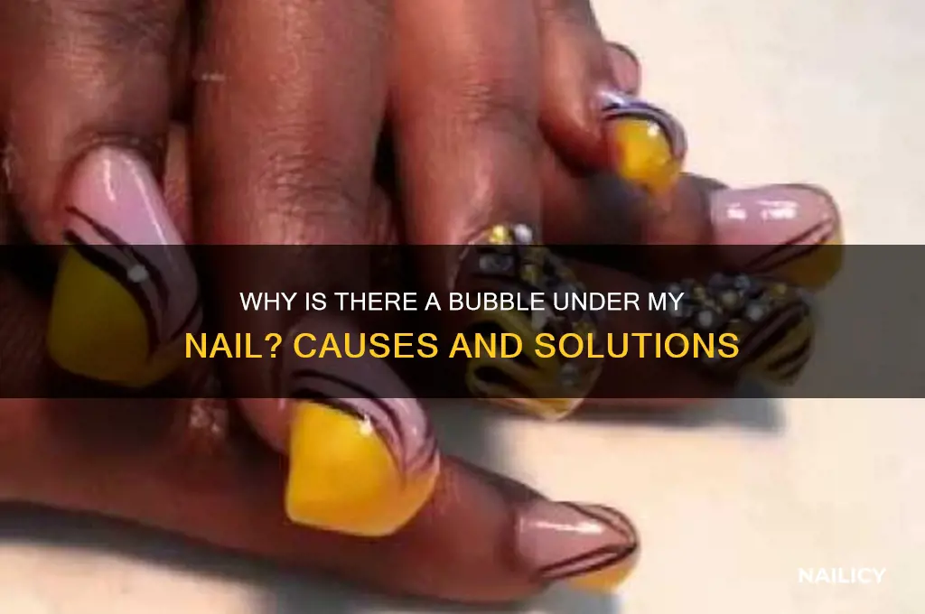 Why Is There A Bubble Under My Nail? Causes And Solutions | Nailicy