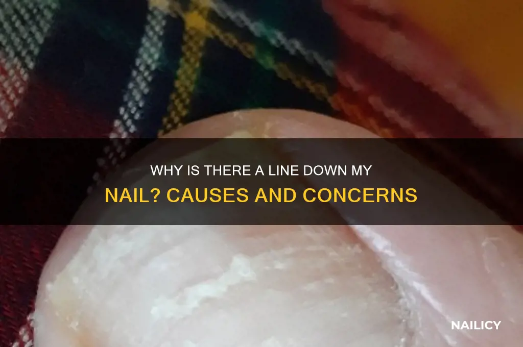 Why Is There A Line Down My Nail? Causes And Concerns | Nailicy