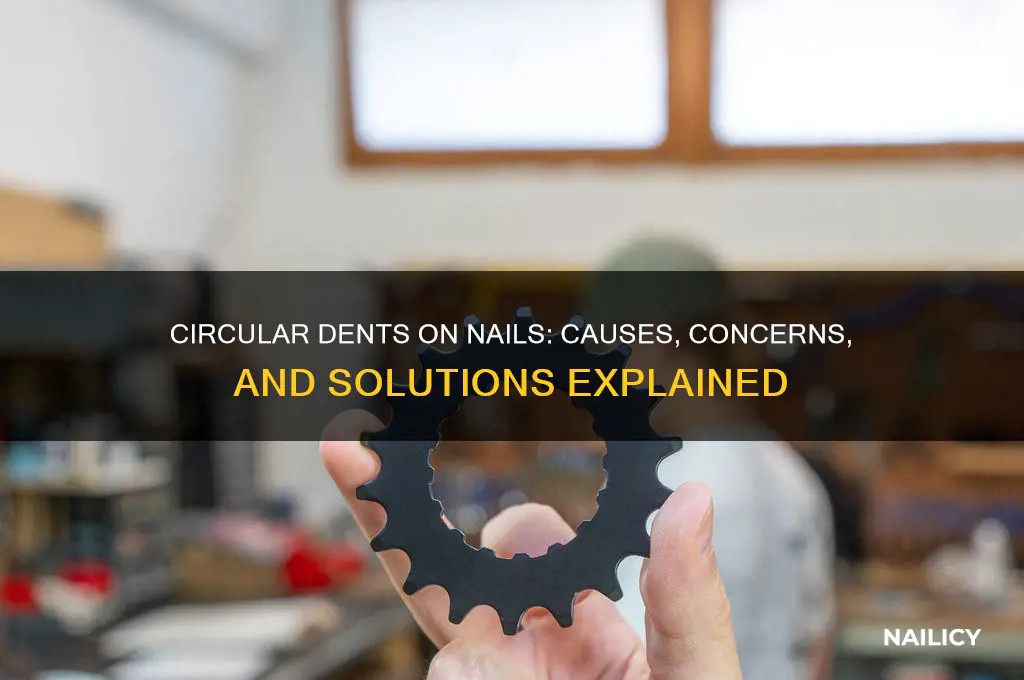 Circular Dents On Nails: Causes, Concerns, And Solutions Explained ...