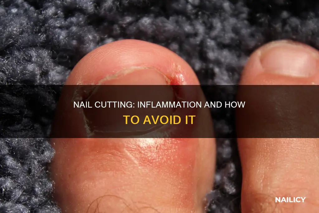 Nail Cutting: Inflammation And How To Avoid It | Nailicy
