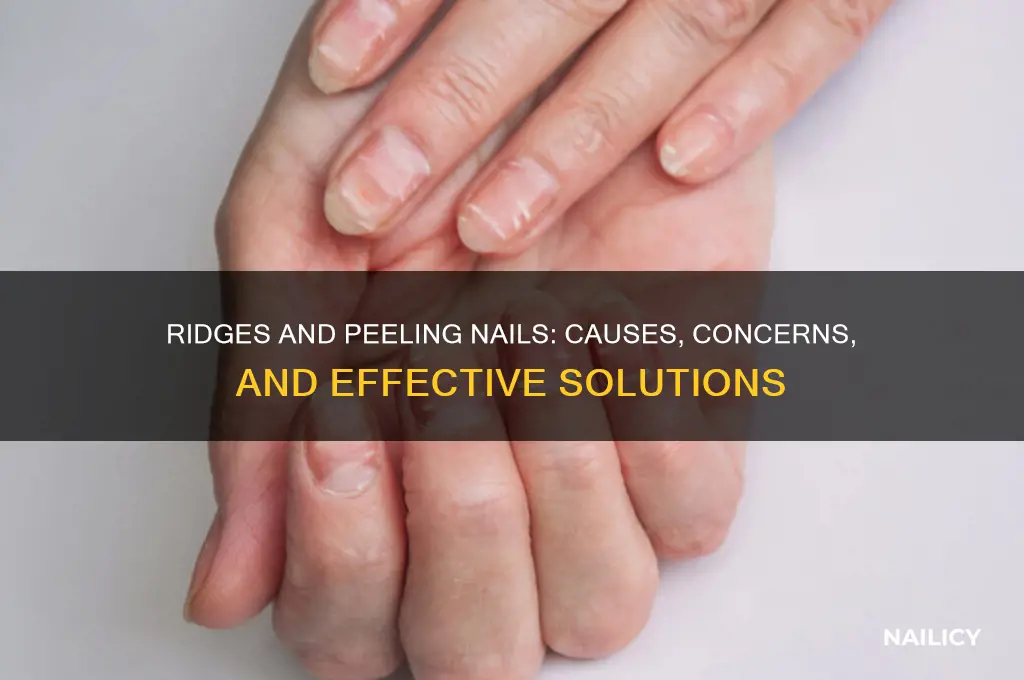 Ridges And Peeling Nails: Causes, Concerns, And Effective Solutions ...