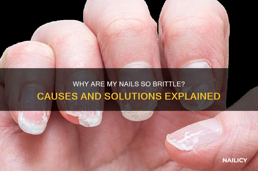 Why Are My Nails So Brittle? Causes And Solutions Explained | Nailicy