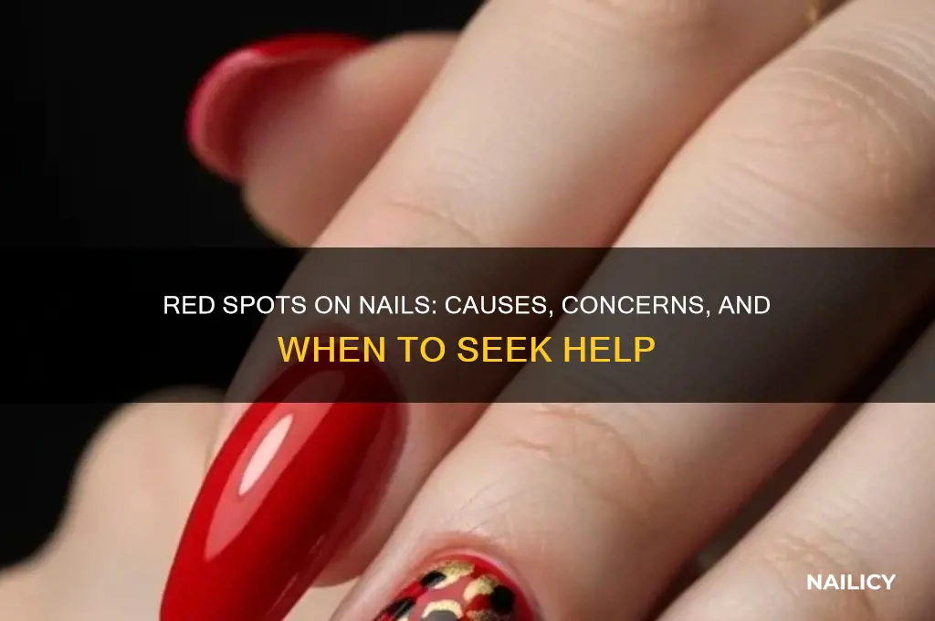 Red Spots On Nails: Causes, Concerns, And When To Seek Help | Nailicy