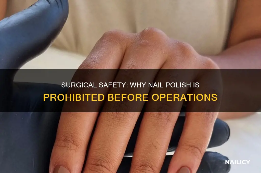 Surgical Safety: Why Nail Polish Is Prohibited Before Operations | Nailicy