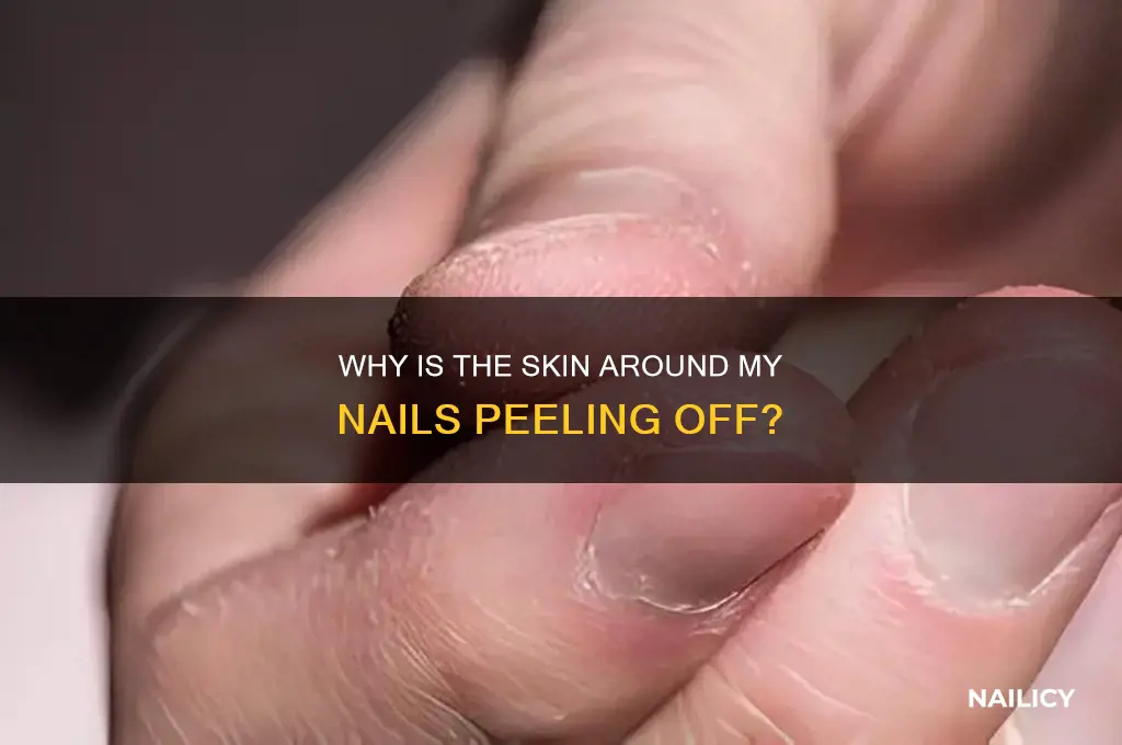 Why Is The Skin Around My Nails Peeling Off? | Nailicy