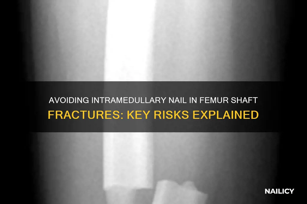 Avoiding Intramedullary Nail In Femur Shaft Fractures: Key Risks ...
