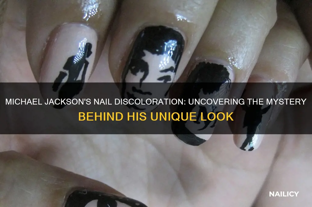 Michael Jackson's Nail Discoloration: Uncovering The Mystery Behind His ...