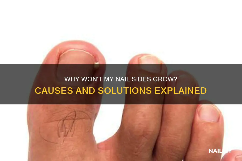 Why Won't My Nail Sides Grow? Causes And Solutions Explained | Nailicy
