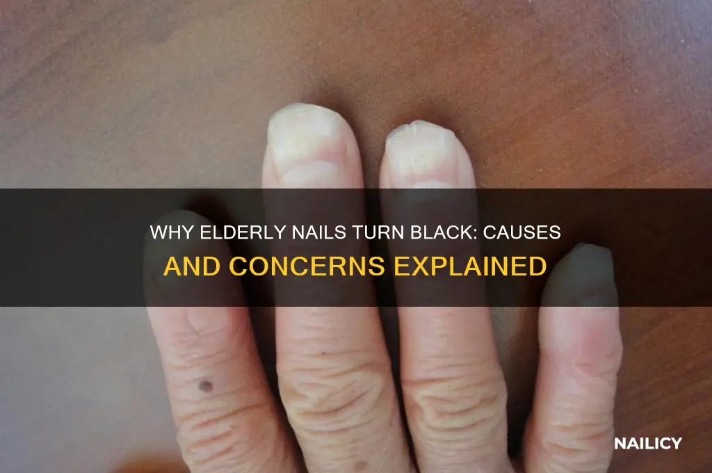 Why Elderly Nails Turn Black: Causes And Concerns Explained | Nailicy