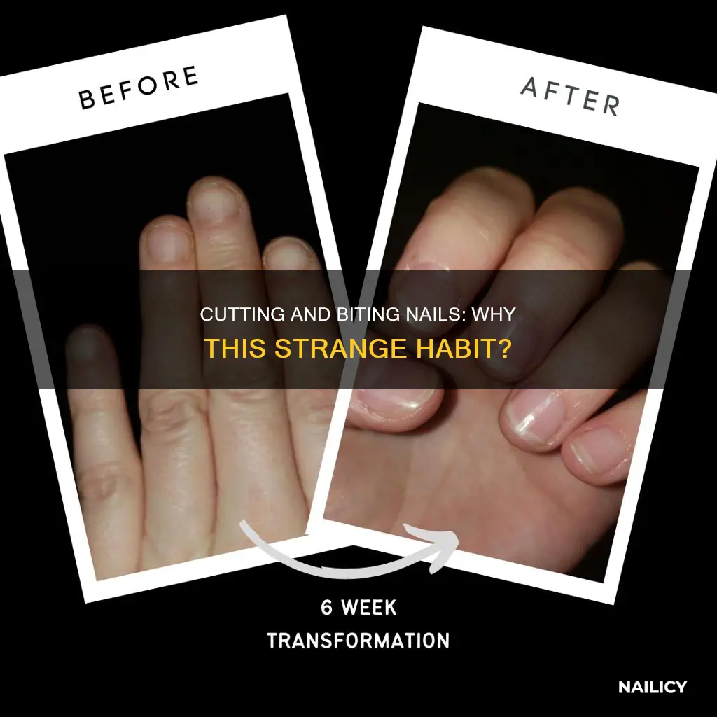 Cutting And Biting Nails: Why This Strange Habit? | Nailicy
