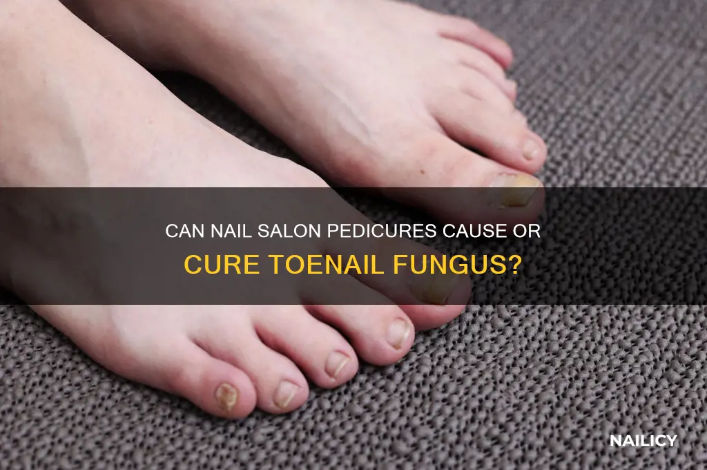Can Nail Salon Pedicures Cause Or Cure Toenail Fungus? | Nailicy