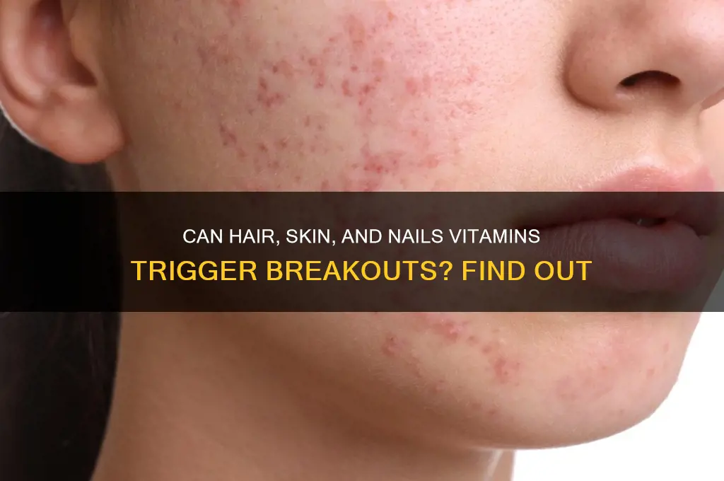 Can Hair, Skin, And Nails Vitamins Trigger Breakouts? Find Out | Nailicy