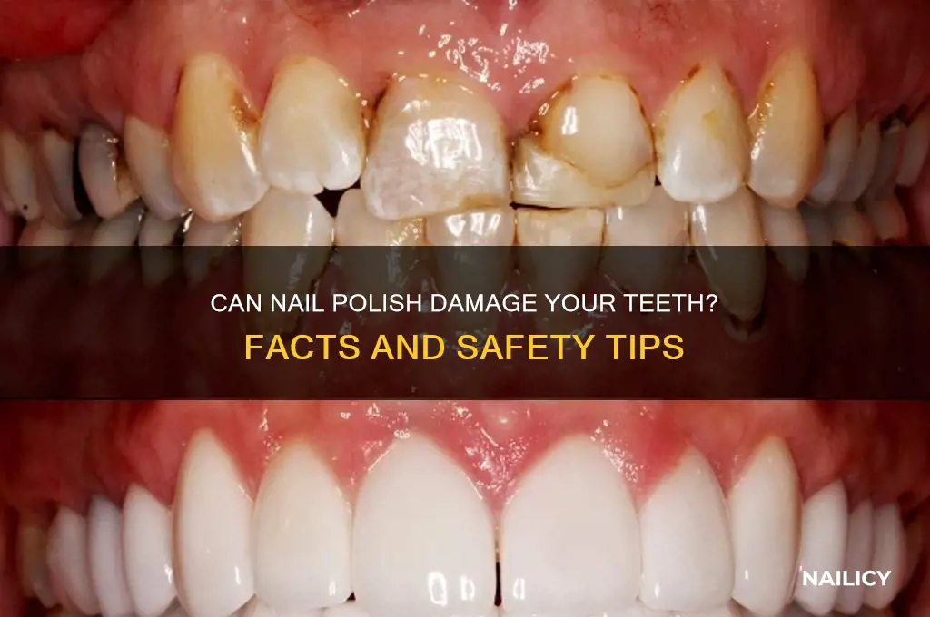 Can Nail Polish Damage Your Teeth? Facts And Safety Tips | Nailicy