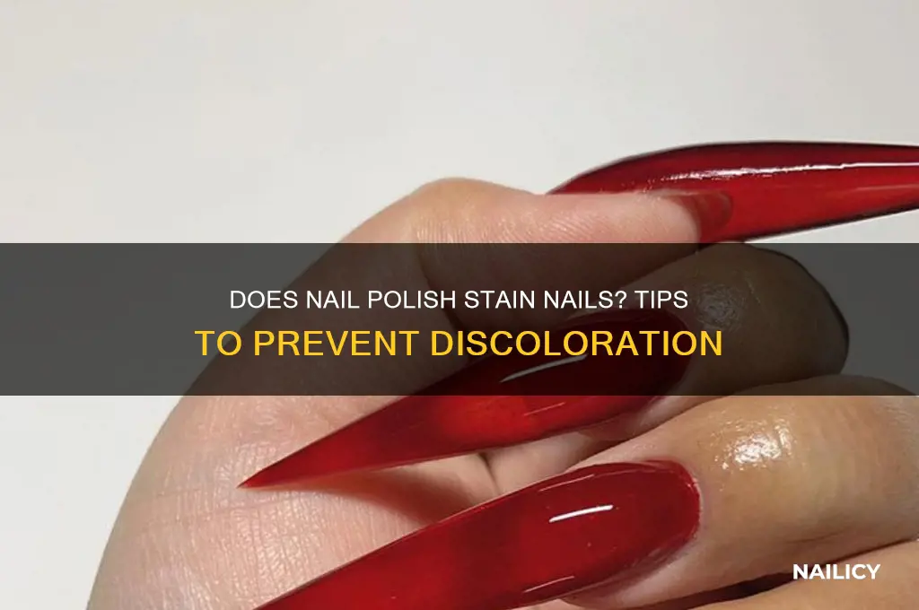 Does Nail Polish Stain Nails? Tips To Prevent Discoloration | Nailicy