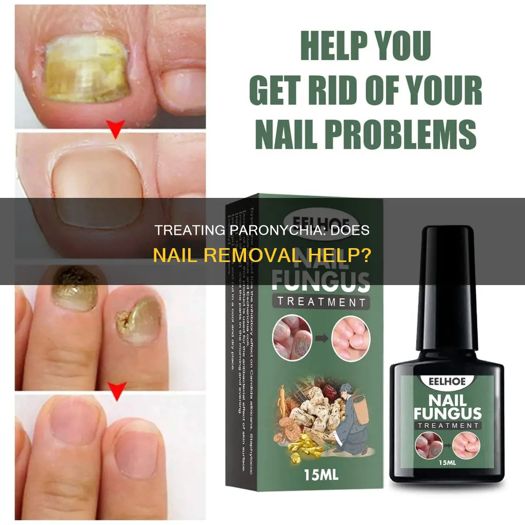 Treating Paronychia: Does Nail Removal Help? | Nailicy