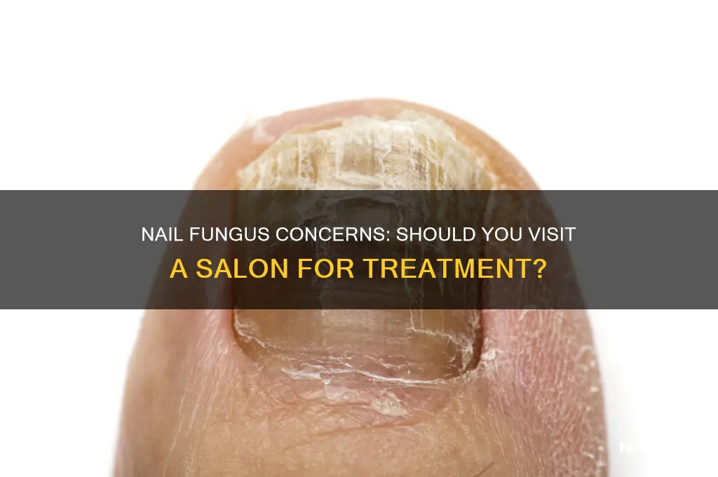 Nail Fungus Concerns: Should You Visit A Salon For Treatment? | Nailicy