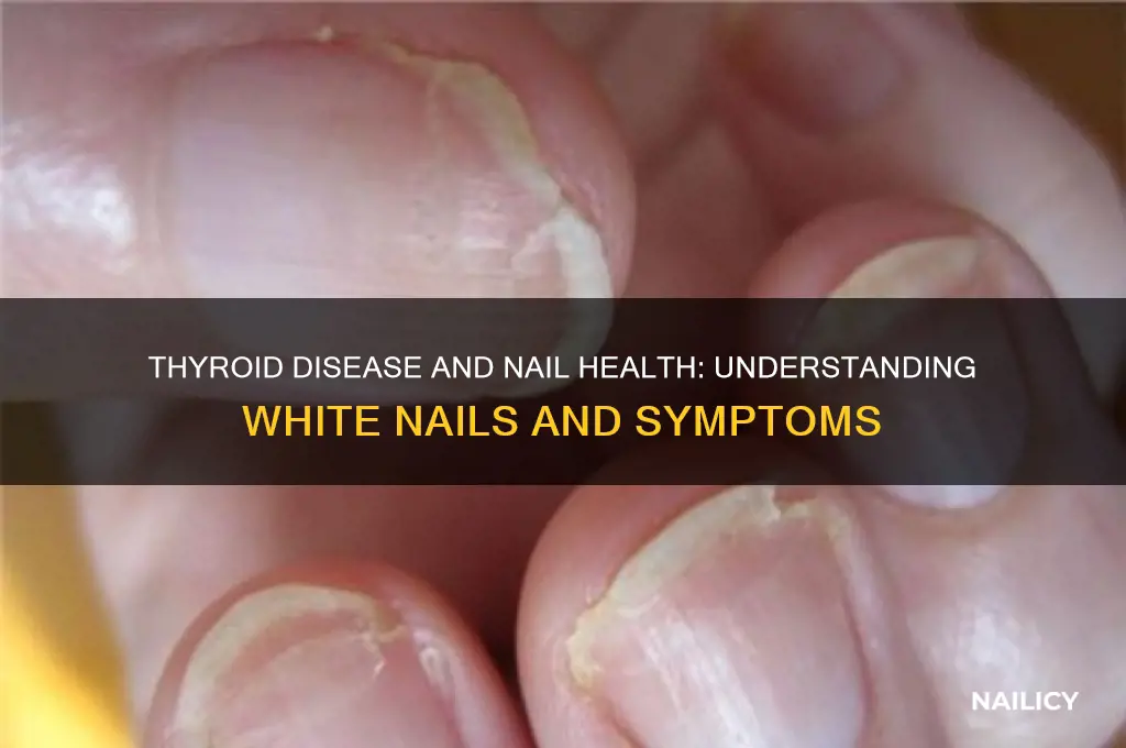 Thyroid Disease And Nail Health: Understanding White Nails And Symptoms ...